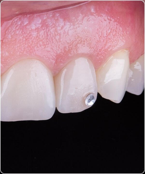 All Dental Treatment List - Best Dental Treatments of Istanbul, Turkey